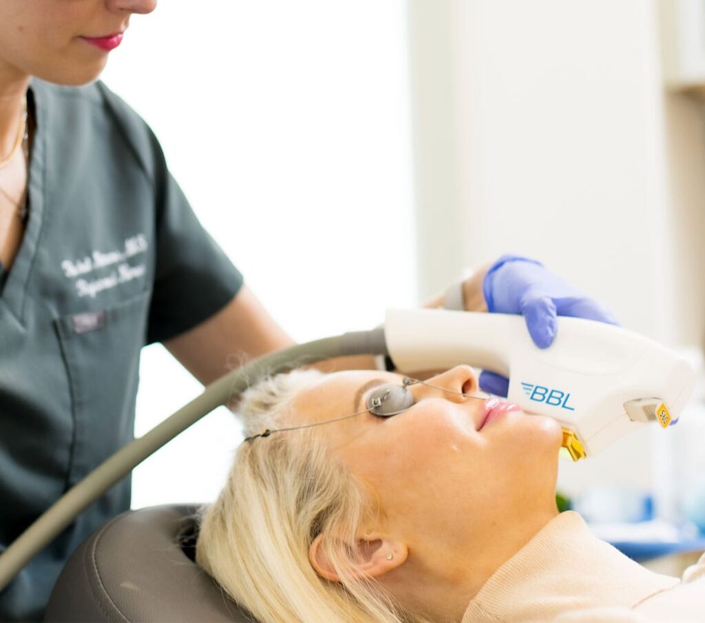 BBL Forever Clear in Dallas, TX | Abbott Aesthetics